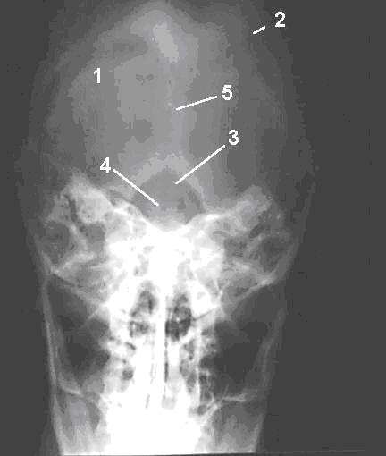 Dr.Sharath's Blog: Townes view