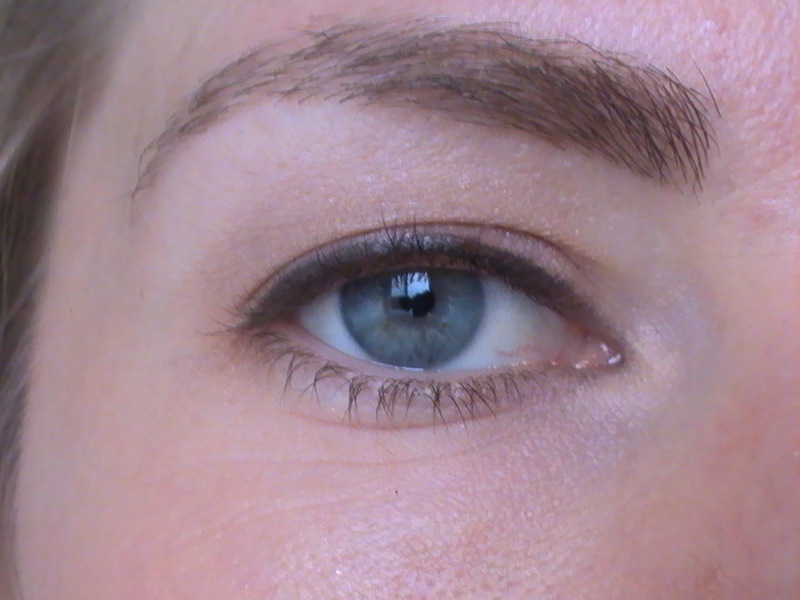 Botox: When to Get it, How to Find a Doctor Who Knows What They’re ...