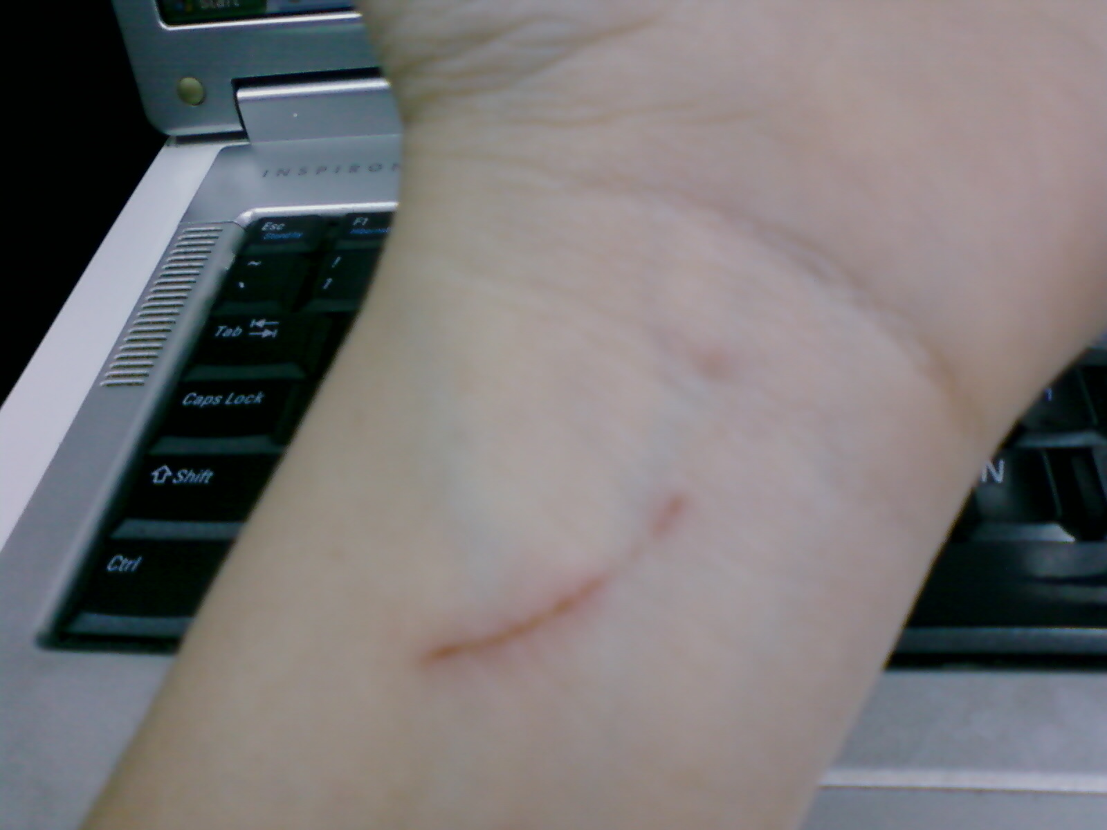 ♥ A cut on the hand ♥ ~ C_melody•向幸福出发