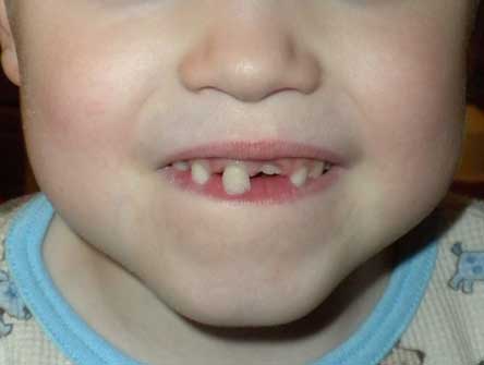 Mrs. Mama's Monsters: Loose Tooth