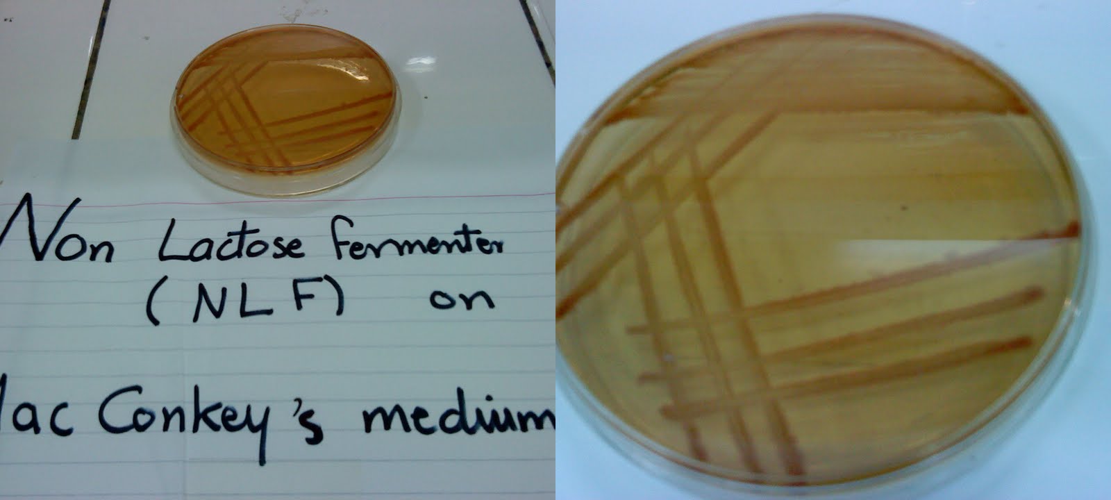 c.E.r.i.T.e.T.e.N.t.A.n.G.k.i.T.e.: Culture Media...