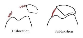 Dansique: Dislocations and Subluxations