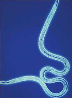 PENYAKIT KAKI GAJAH DAN PEMBENGKAKAN BUAH PELIR | REFERENSI PENYAKIT