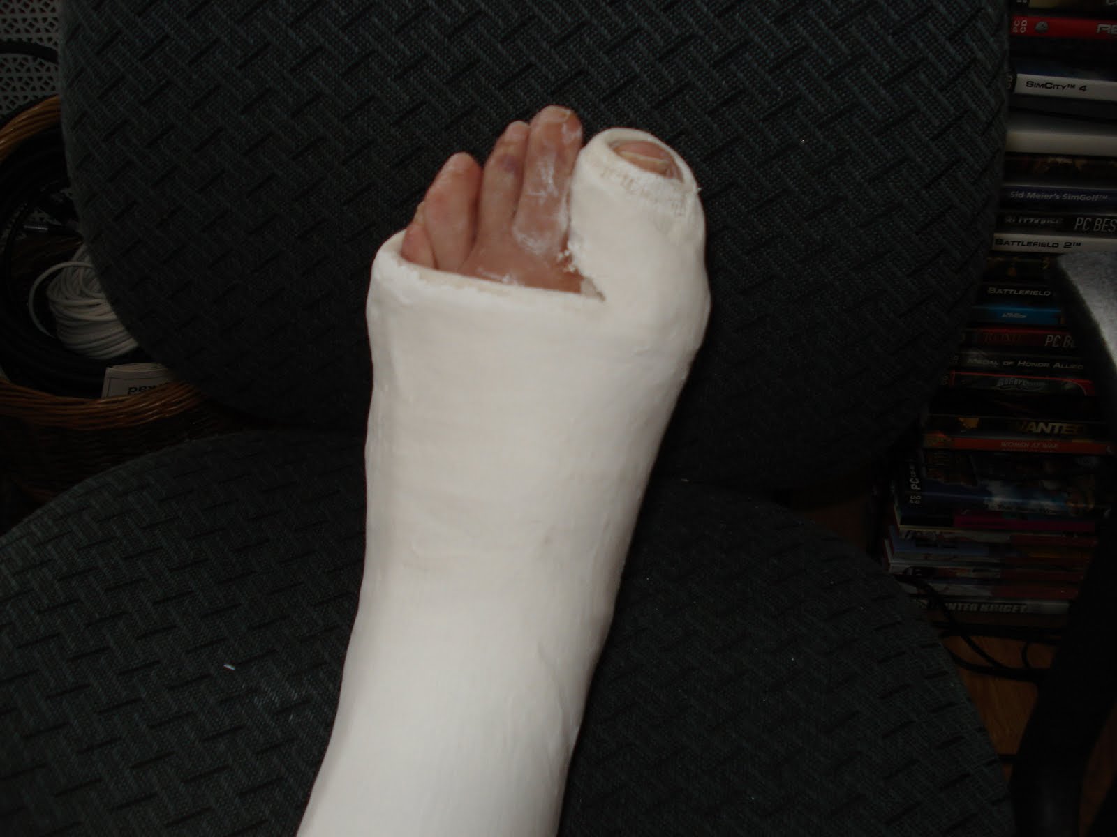 Irenes knitting: Nytt gips idag. ( Got a new cast today.)
