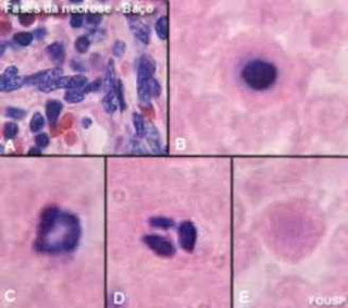 Conhecendo a bio: MORTE CELULAR