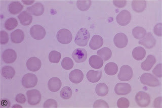 HITUNG RETIKULOSIT | Health Analys